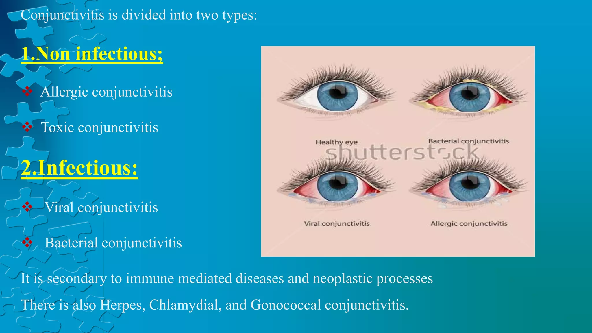 Conjunctivitis | PPTX