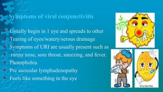 Conjunctivitis | PPTX
