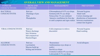 Conjunctivitis | PPTX