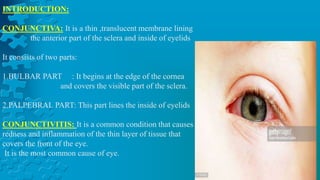 Conjunctivitis | PPTX