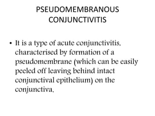 Conjunctivitis | PPTX