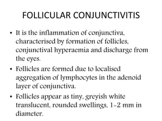 Conjunctivitis | PPTX