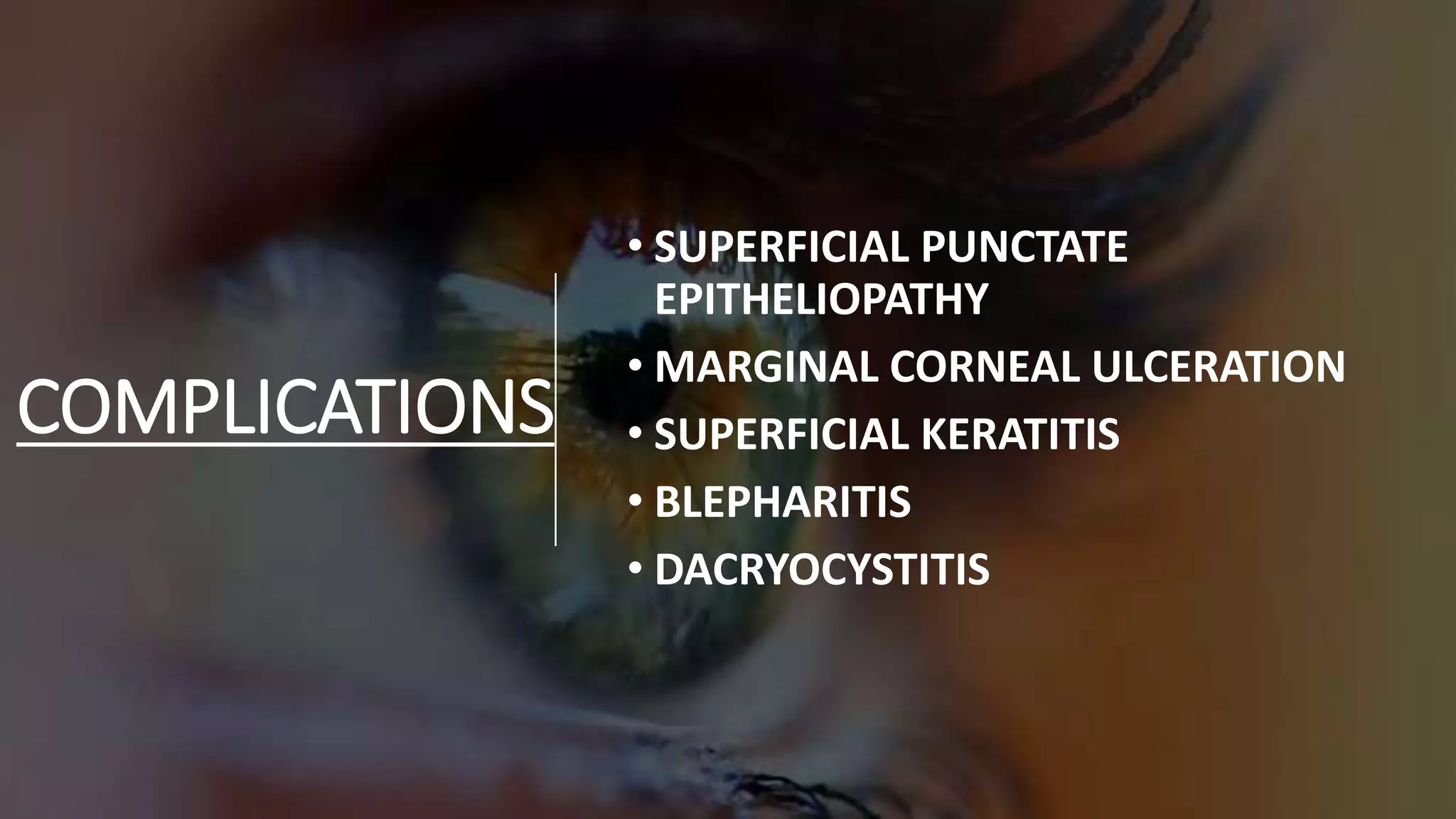 Conjunctivitis | PPTX