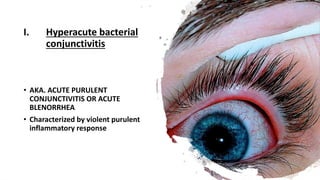 Conjunctivitis | PPTX