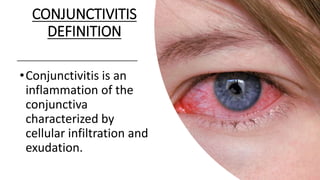 Conjunctivitis | PPTX