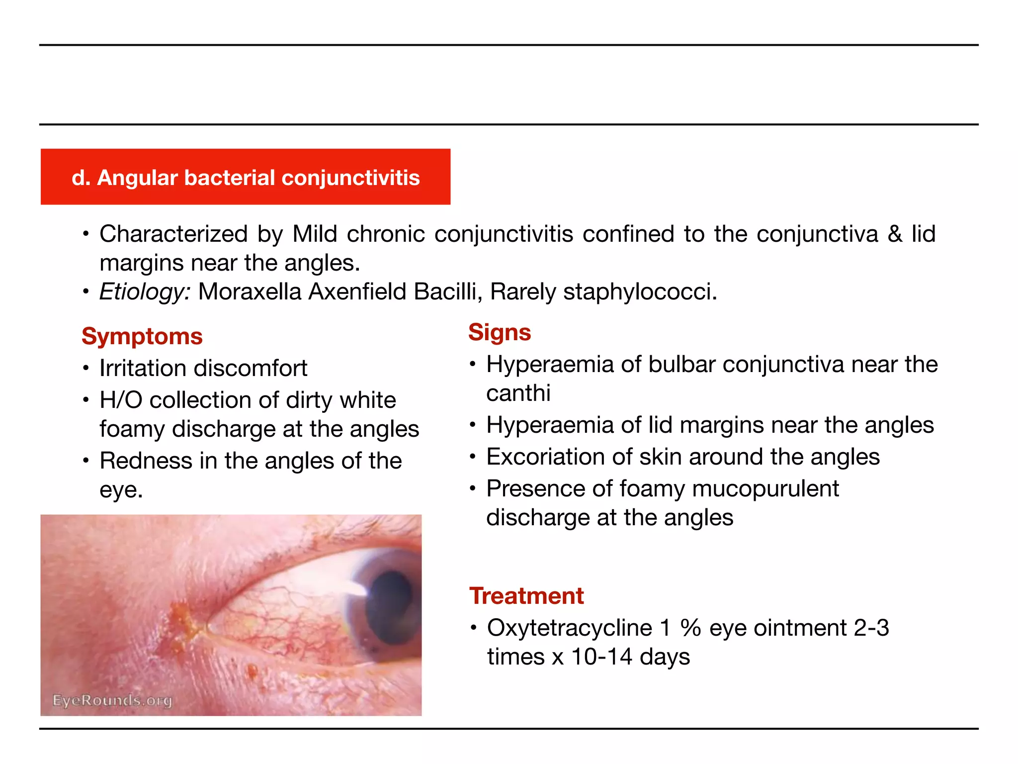 Conjunctivitis | PDF