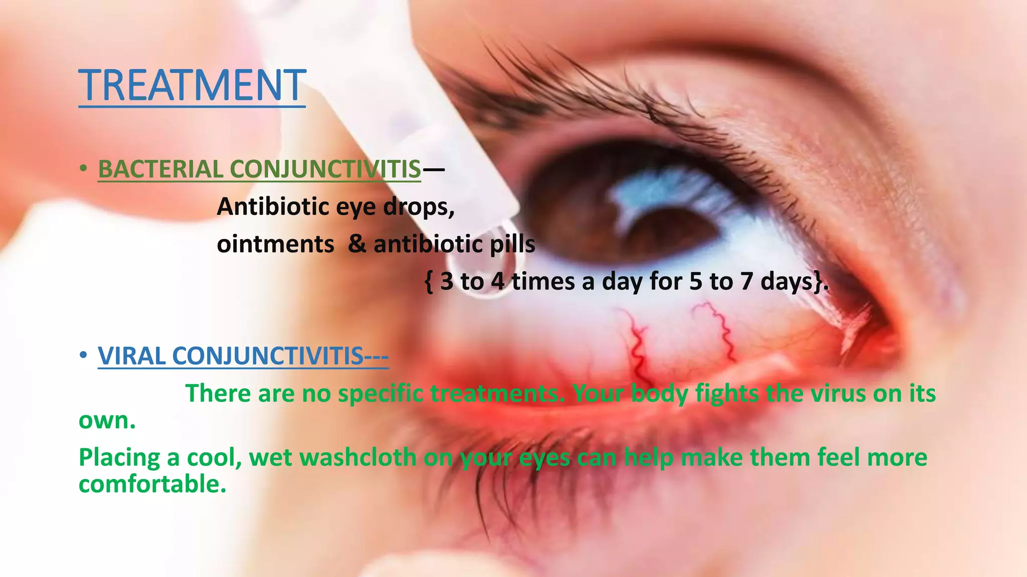 Conjunctivitis | PPT