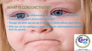 Conjunctivitis | PPT