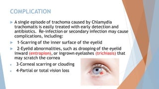 Conjunctivitis | PDF
