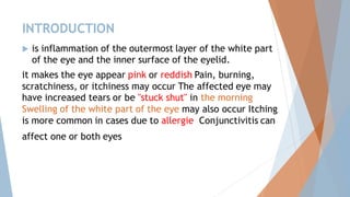 Conjunctivitis | PPT