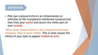 Conjunctivitis | PPT