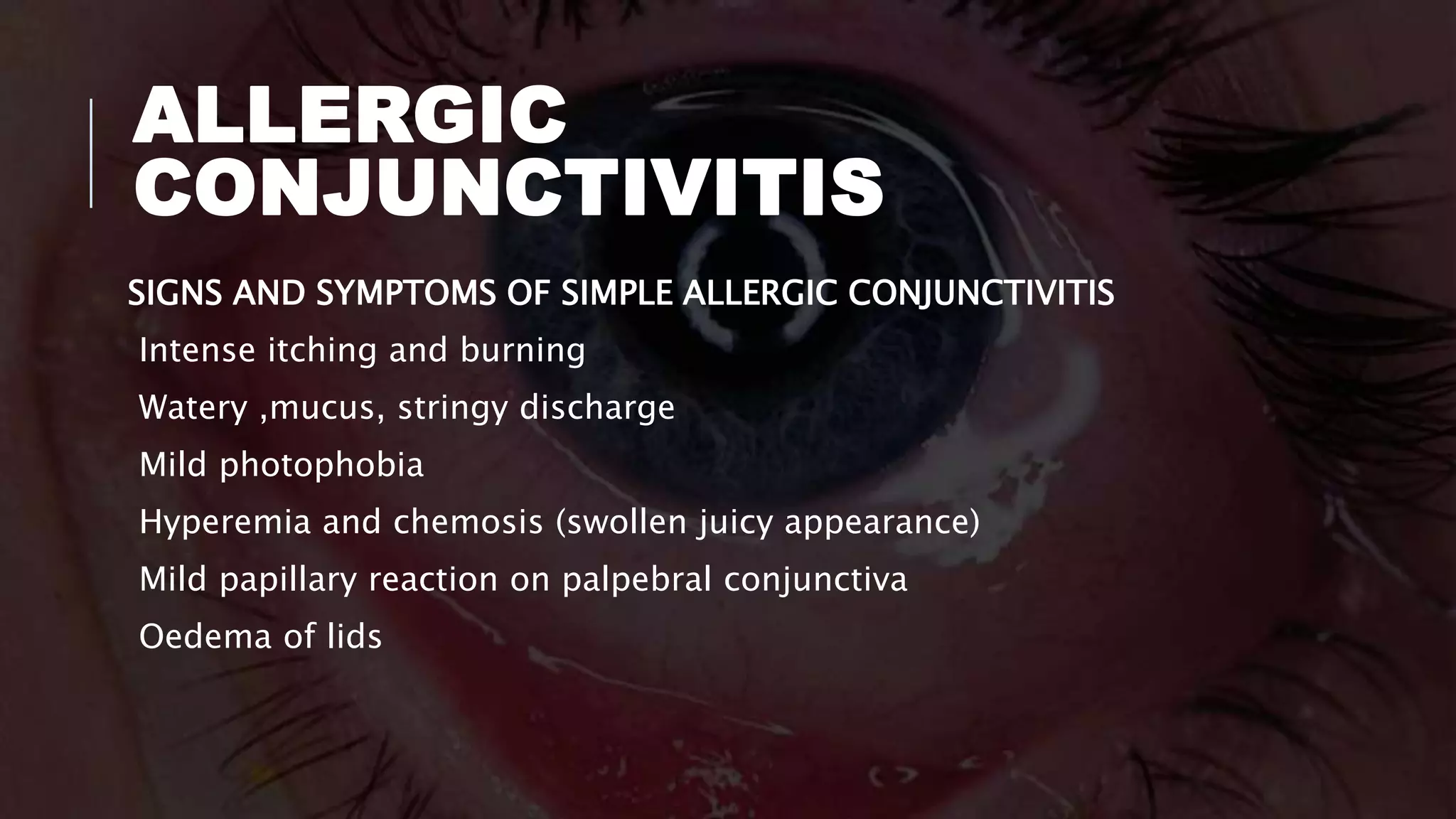 conjunctivitis.pptx
