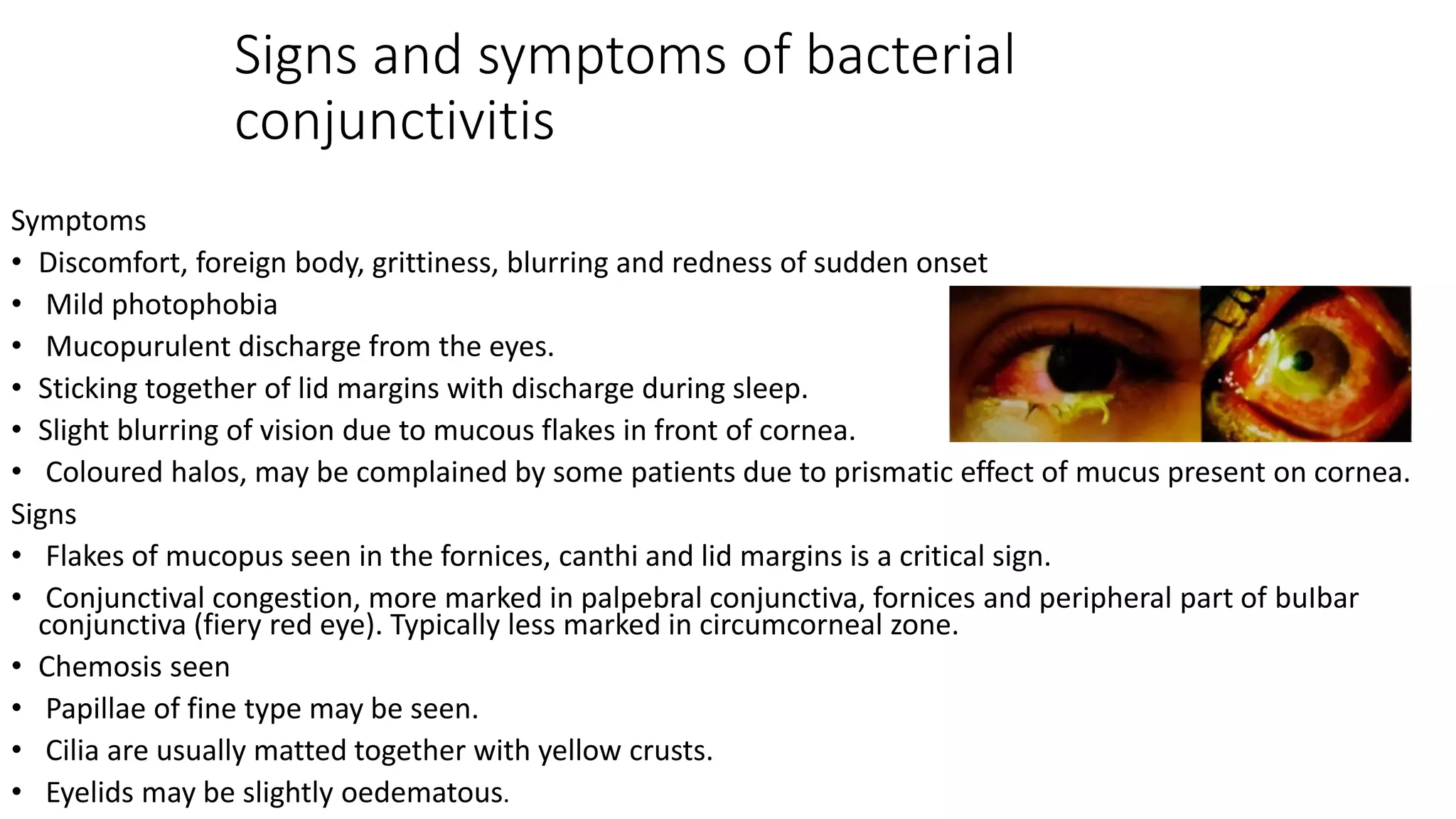 conjunctivitis.pptx
