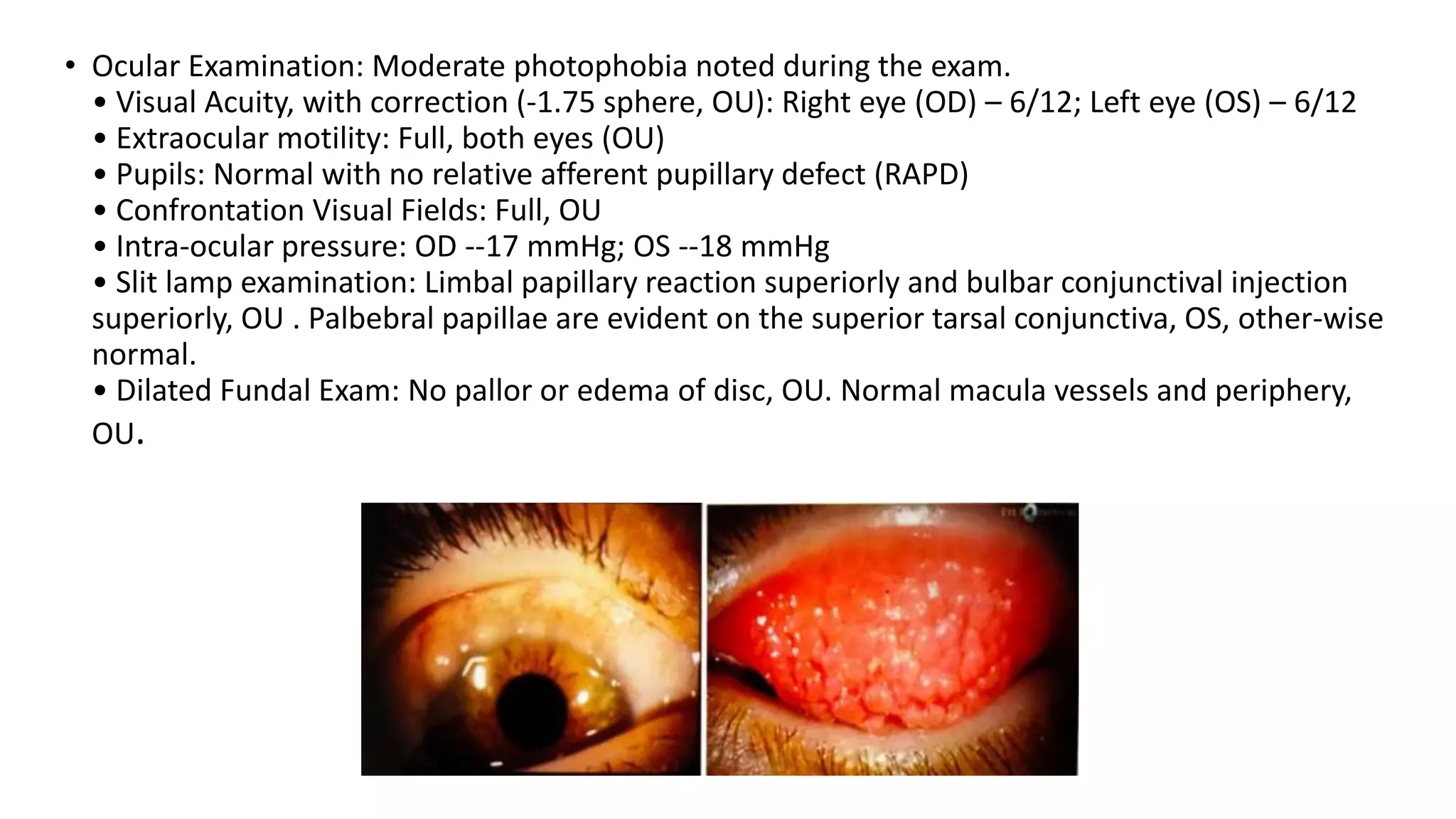 conjunctivitis.pptx