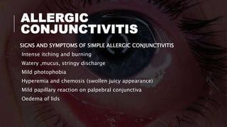 conjunctivitis.pptx