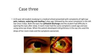 conjunctivitis.pptx
