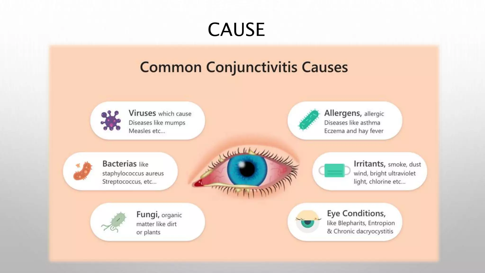 CONJUNCTIVITIS.pptx