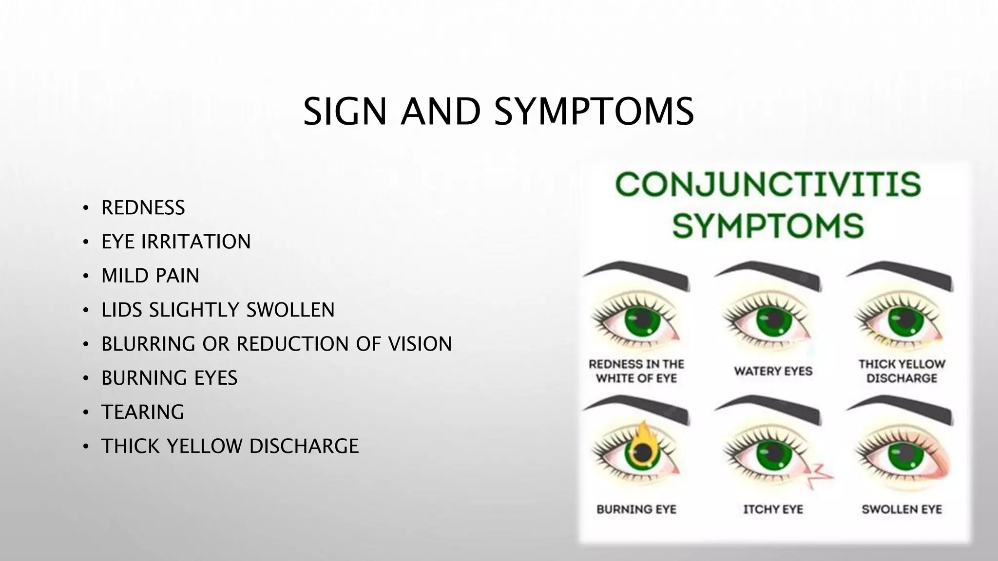 CONJUNCTIVITIS.pptx