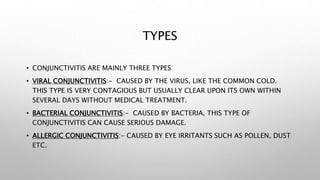 CONJUNCTIVITIS.pptx