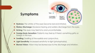 conjunctivitis.pdf