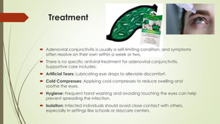conjunctivitis.pdf
