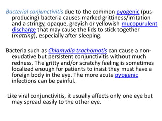conjunctivitis.ppt