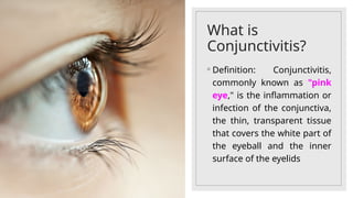 Conjunctivitis.pptx PPT | PPTX