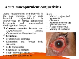 CONJUNCTIVITIS .pptx inflammation of the conjunctiva and types | PPTX