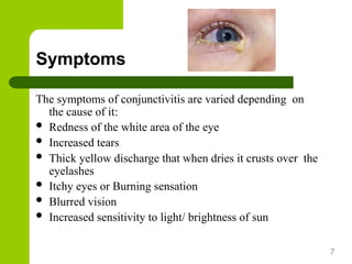 conjunctivitis etiopathogenesis and clinical manifestations | PPT