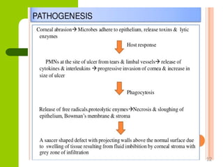 conjunctivitis.pathogenesis and etiology | PPT