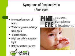 conjunctivitis.pathogenesis and etiology | PPT