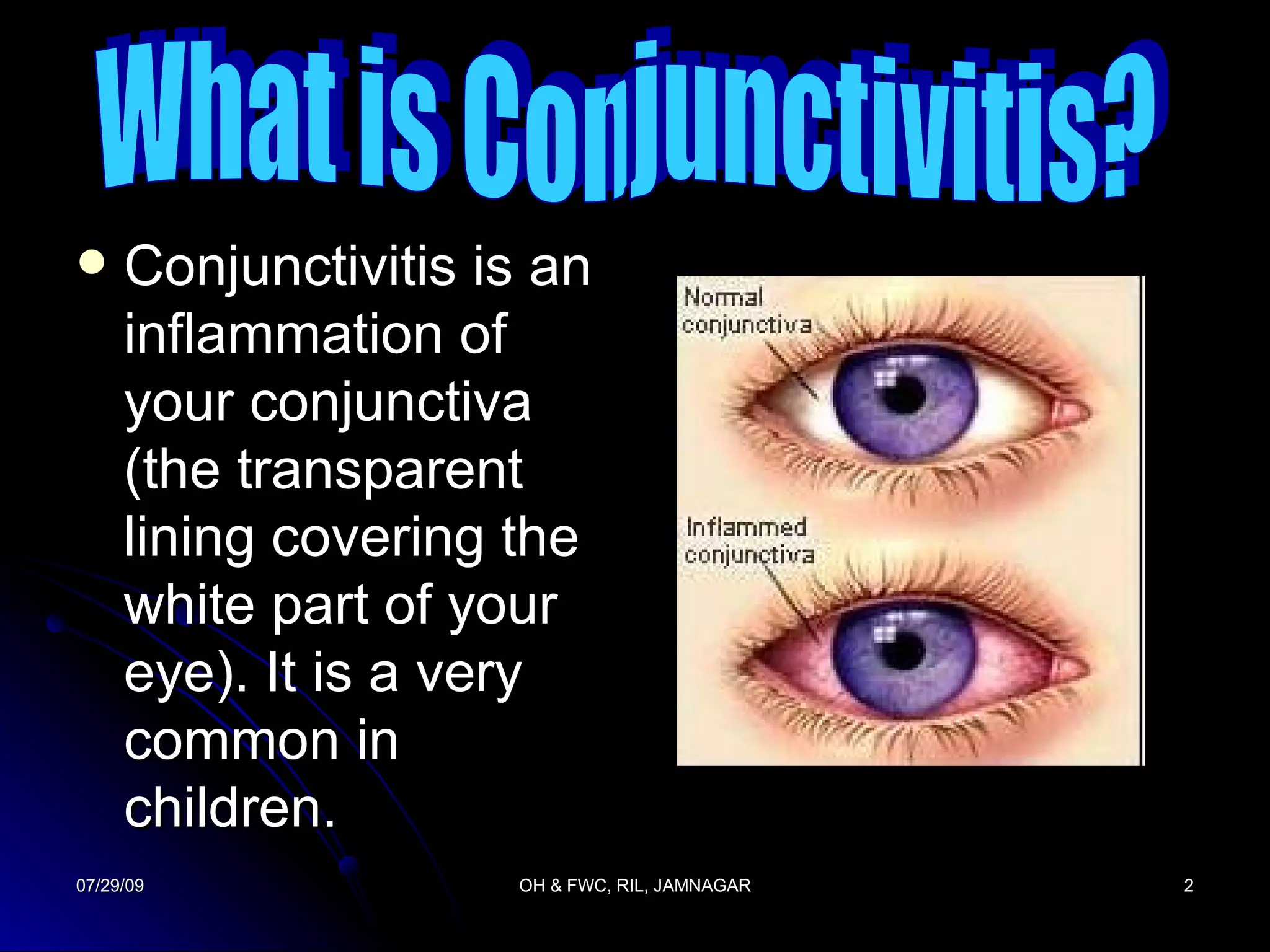 Conjunctivitis | PPT