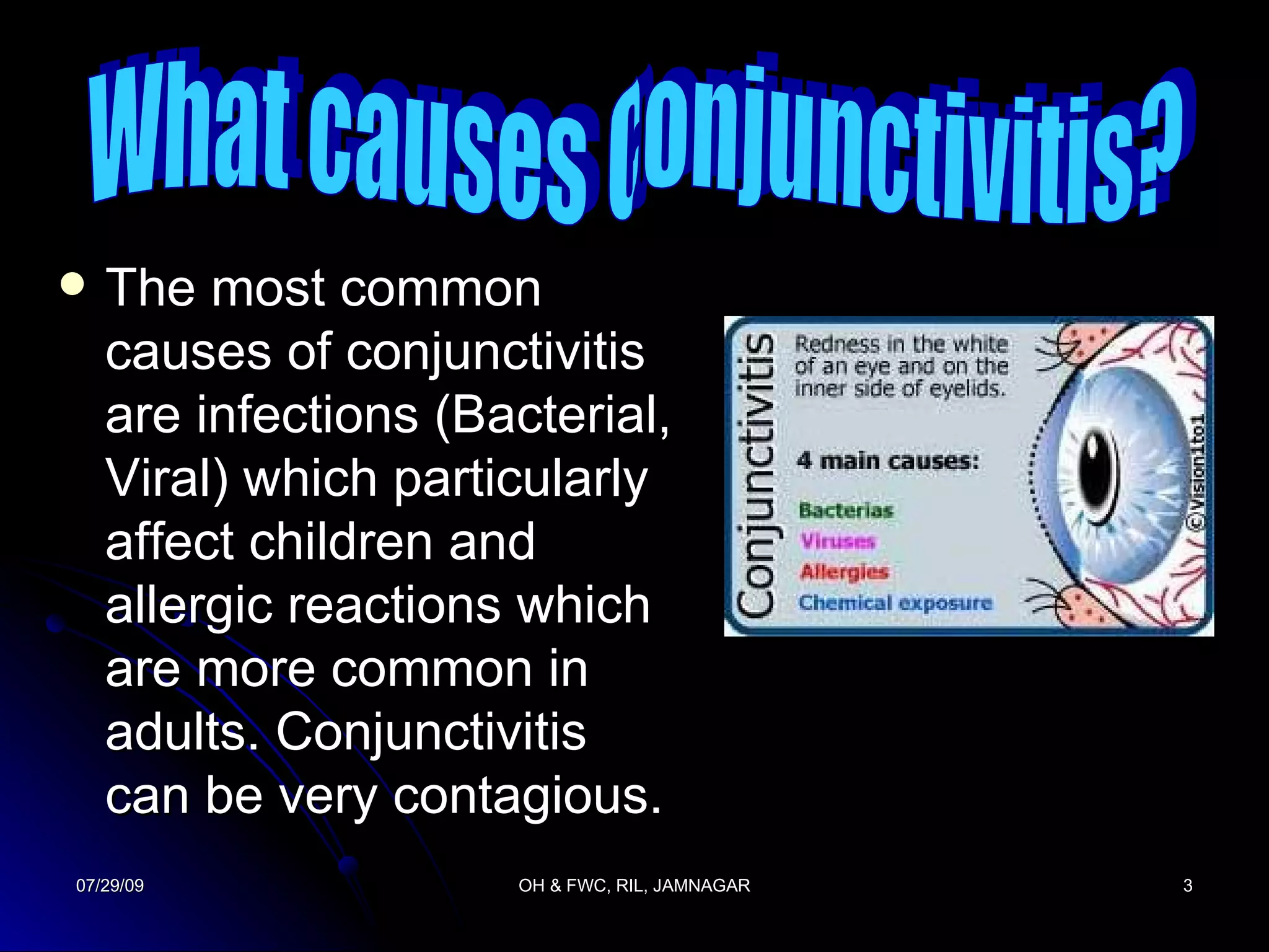 Conjunctivitis | PPT
