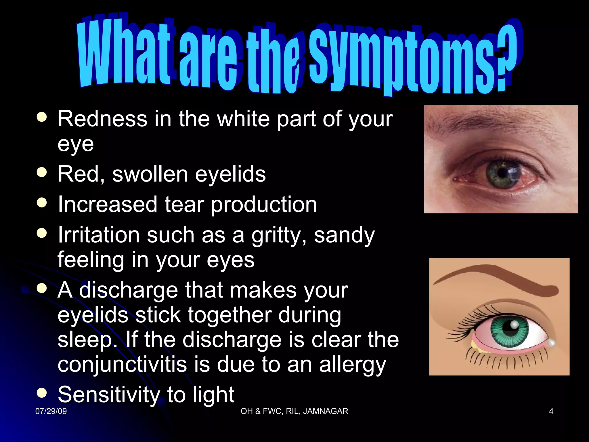 Conjunctivitis | PPT