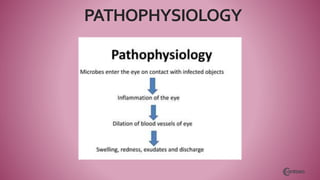 Conjunctivitis - its types, clinical manifestation and nursing ...