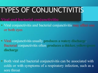 conjunctivitis-mgmt.pptx