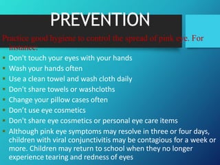 conjunctivitis-mgmt.pptx