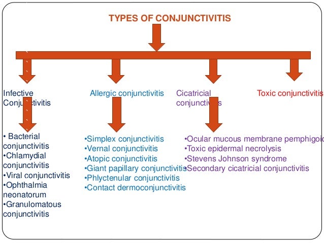 Conjunctivitis