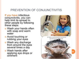Conjunctivitis by Muhammad ibrahim | PPSX