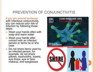 Conjunctivitis by Muhammad ibrahim | PPSX