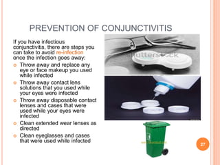 Conjunctivitis by Muhammad ibrahim | PPSX