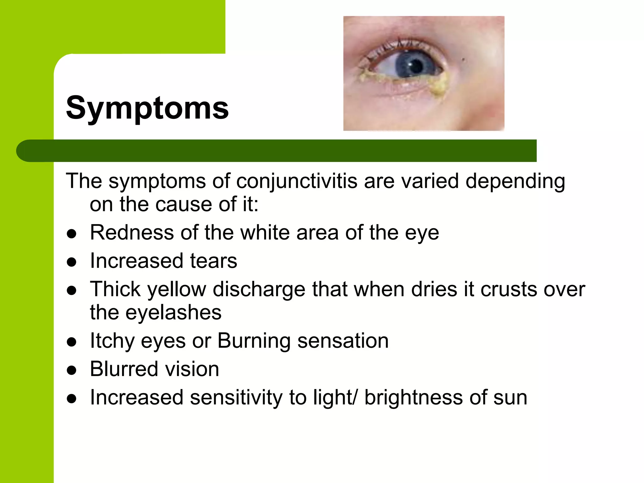 Conjunctivitis final presentation | PPTX