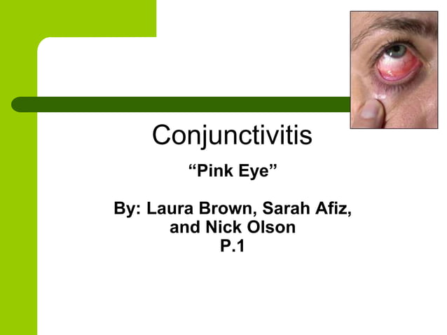 Conjunctivitis final presentation | PPTX