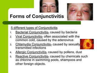 Conjunctivitis final presentation | PPTX