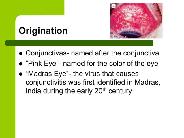 Conjunctivitis final presentation | PPTX