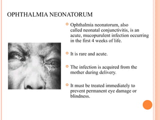 a presentation on conjunctivitis in newborn.ppt