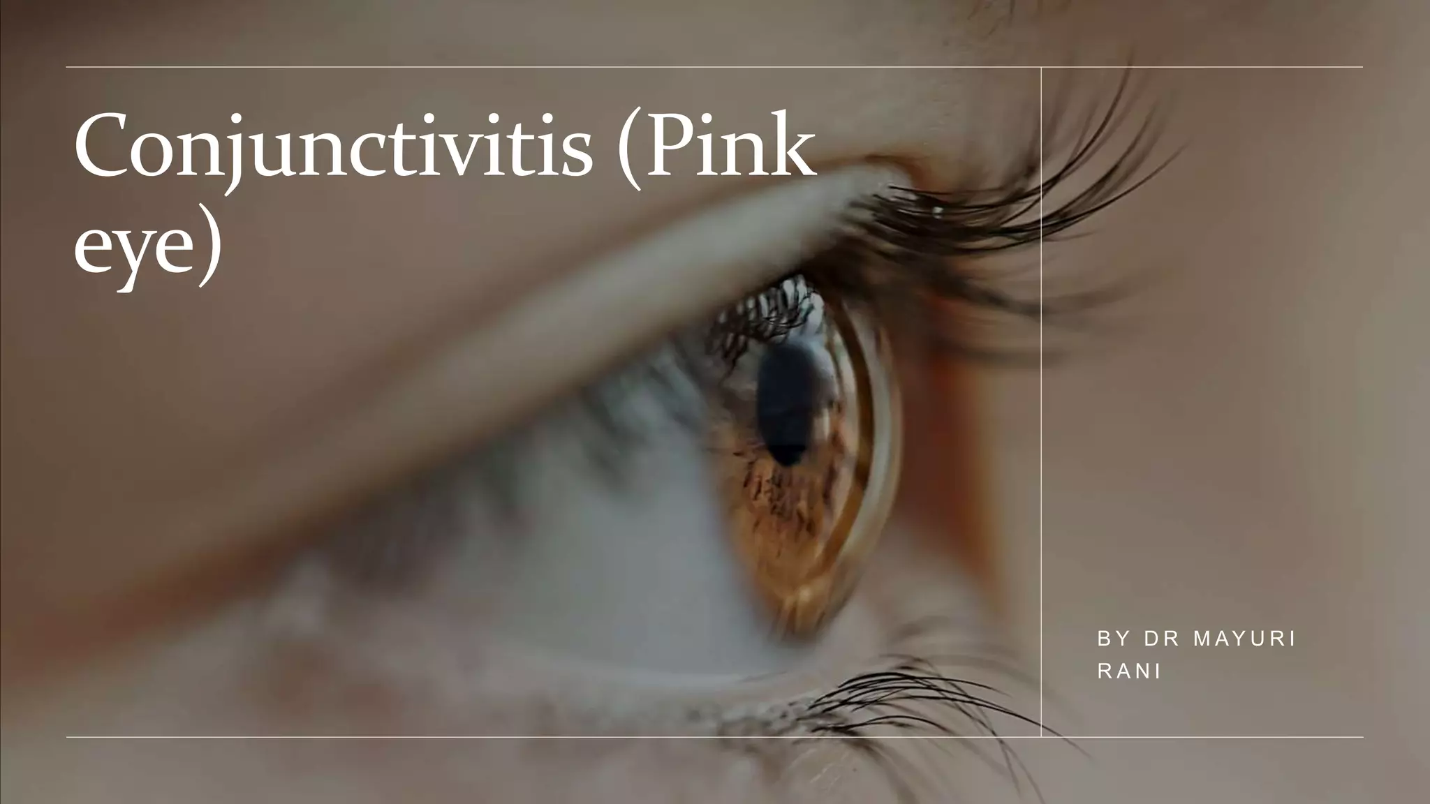 Conjunctivitis( Pink eye).pptx