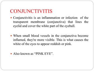 Conjunctivitis presentation (2).pptx