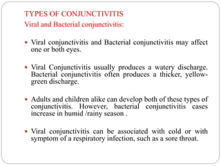 Conjunctivitis presentation (2).pptx
