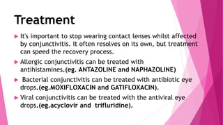 Conjunctivitis harun malik | PPTX